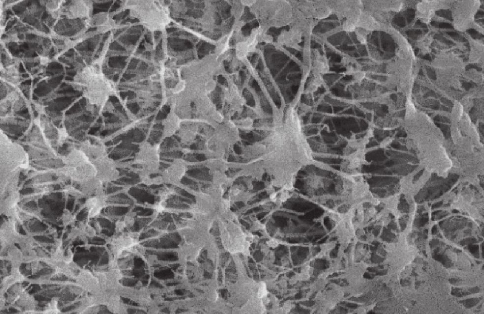 什么是ePTFE材料？